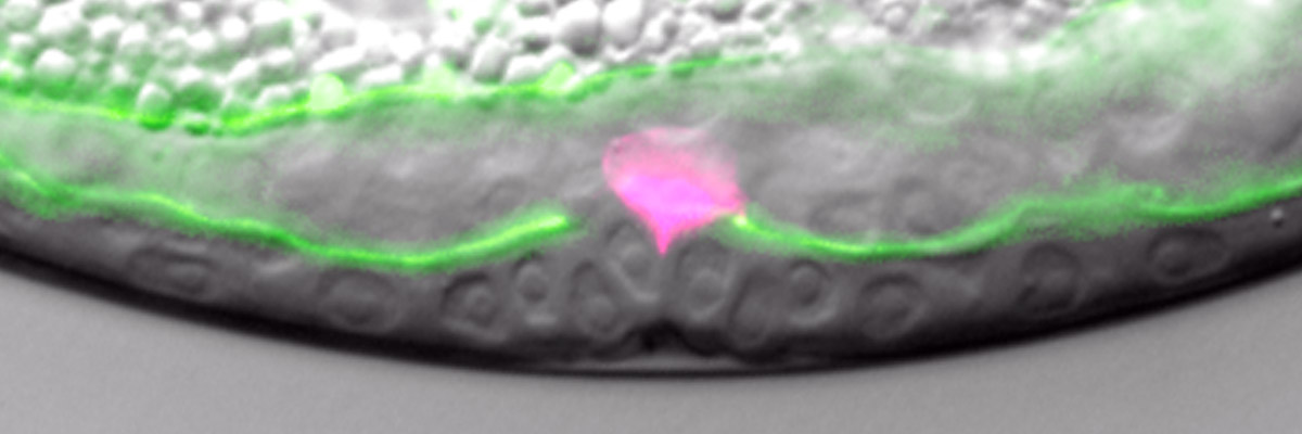 Anchor Cell invasion | Department of Molecular Life Sciences | UZH